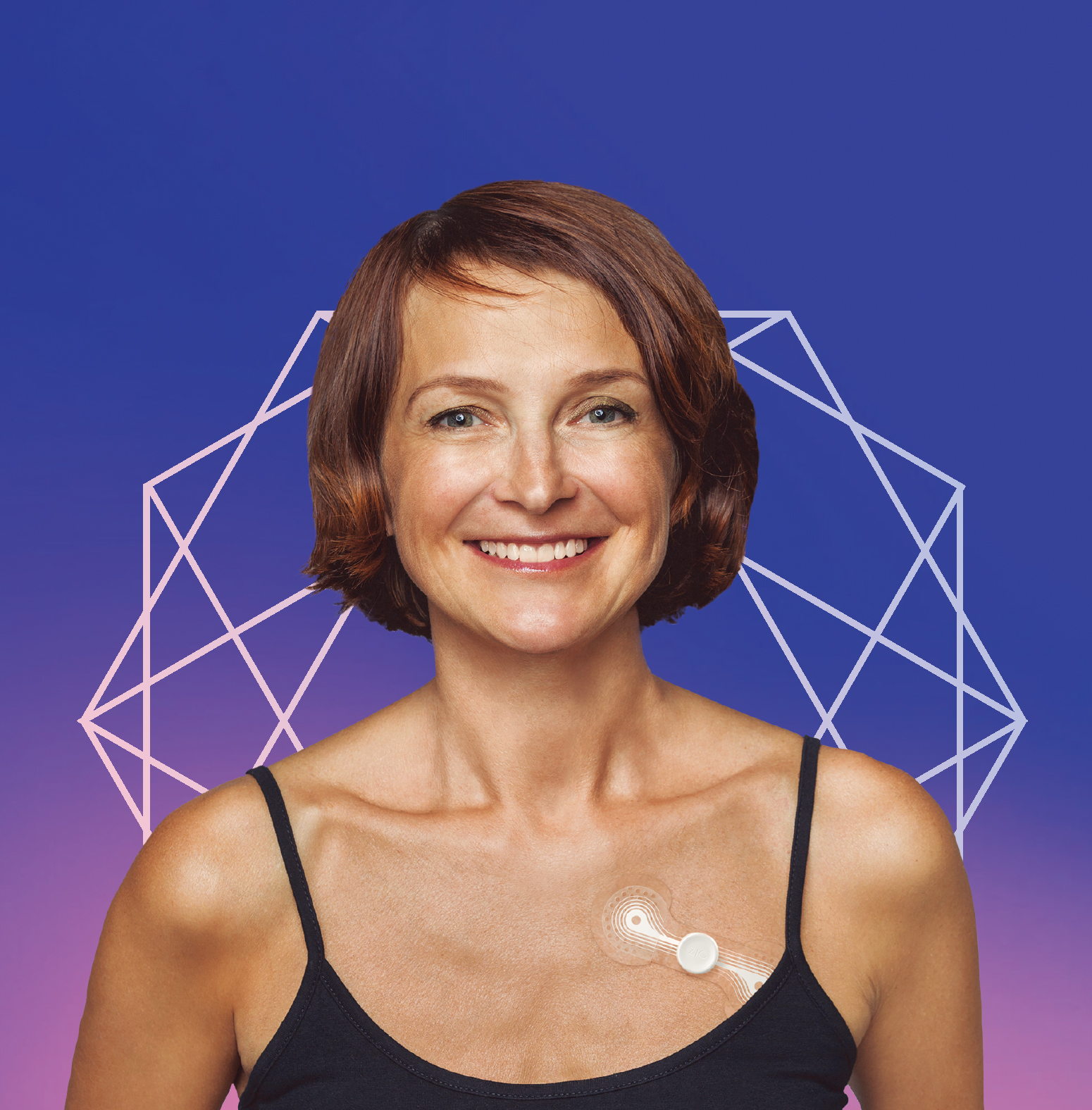 Cardiac Ambulatory ECG Long-Term Continuous Monitoring Service | SENKO ...