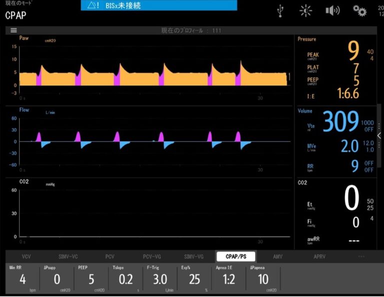 自発呼吸のお助けモード⁉CPAPとPSVについて - MERA 泉工医科工業株式会社 ―医療と共に歩む、信頼のメラ製品―