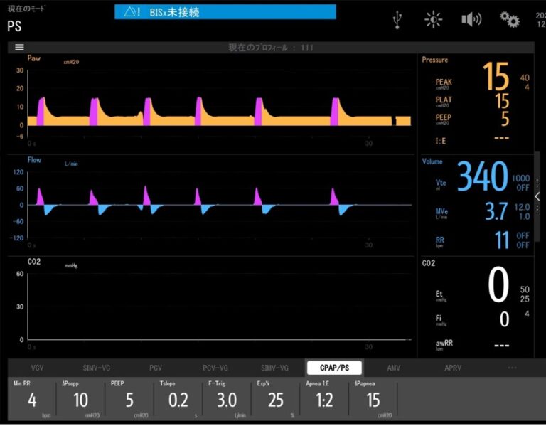 自発呼吸のお助けモード⁉CPAPとPSVについて - MERA 泉工医科工業株式会社 ―医療と共に歩む、信頼のメラ製品―